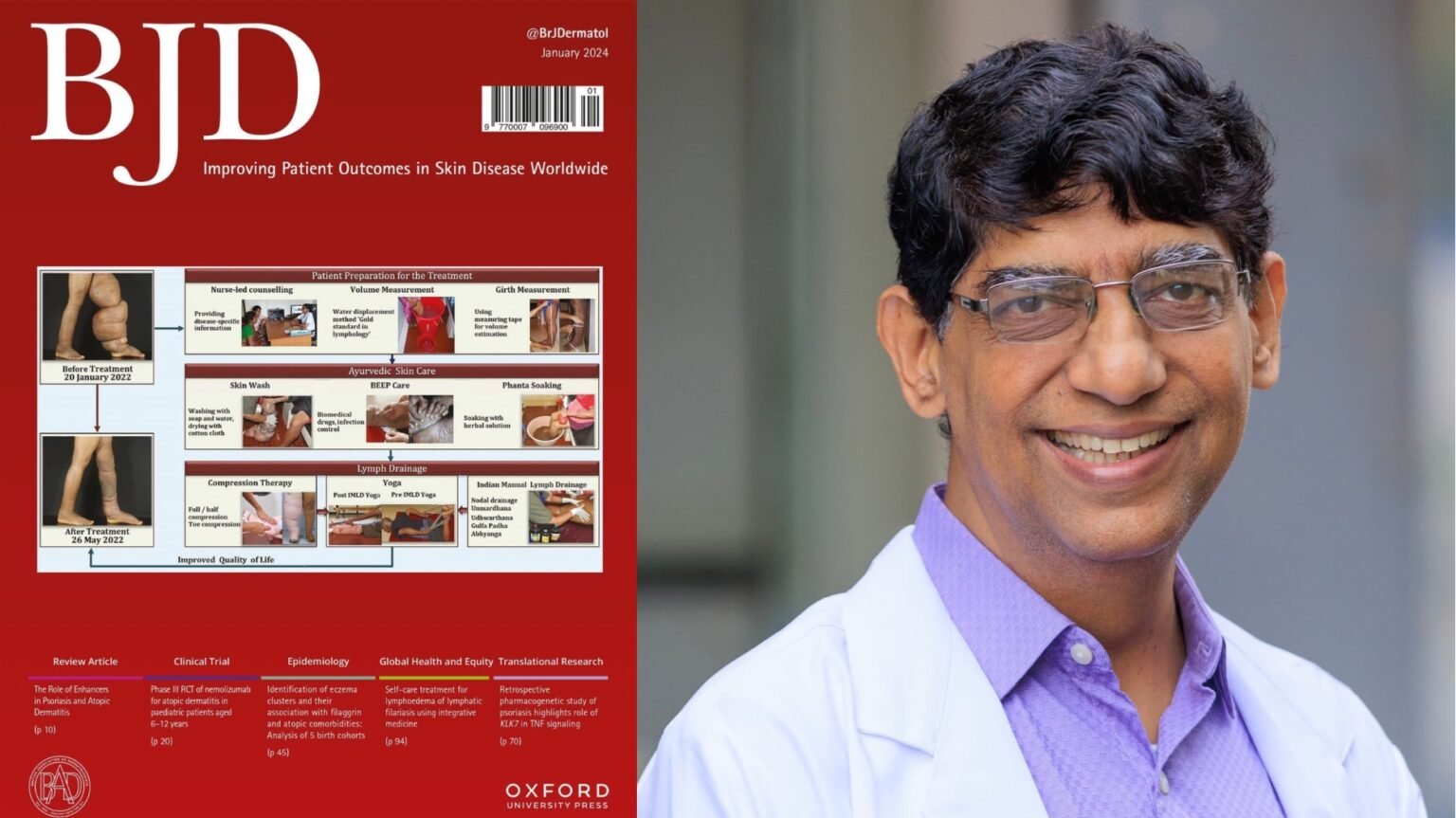 Kerala doctor wins global acclaim as British Journal of Dermatology ...